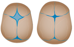 Quiz & Worksheet - Development of the Axial Skeleton | Study.com