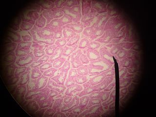 Sertoli Cells Definition, Function & Location - Lesson | Study.com