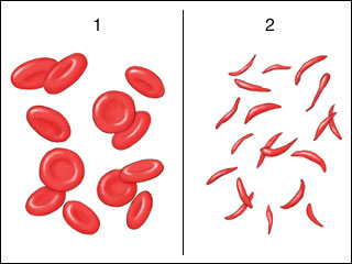 Single Gene Inheritance | Definition, Examples & Disorders - Lesson ...