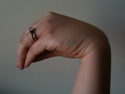 Hypomagnesemia | Symptoms, Causes & Diagnosis | Study.com