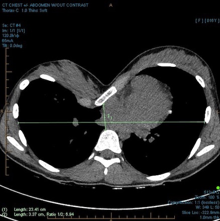 Diagnosis Definition & Process - Lesson | Study.com