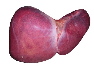 Liver Laceration | Grading, Treatment & Complications - Lesson | Study.com