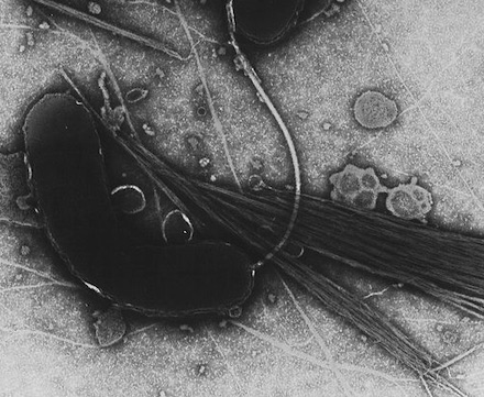 Cholera | Overview, History & Pandemic | Study.com