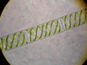 Spirogyra | Characteristics & Locomotion - Lesson | Study.com
