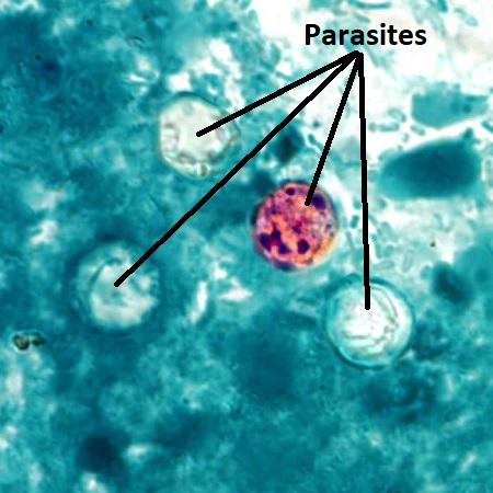 Collecting and Analyzing in Gastrointestinal Sites | Study.com