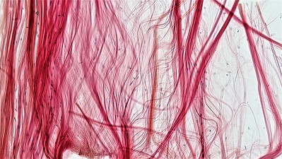 Collagen Fibers | Definition, Anatomy & Types - Lesson | Study.com