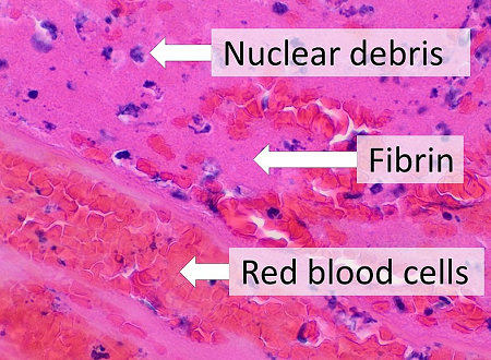 Red Blood Cells | Functions, Anatomy & Facts - Lesson | Study.com