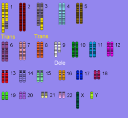 Analyzing a Karyotype to Identify Chromosomal Abnormalities Practice ...