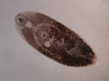 Helminths | Definition, Transmission & Examples - Lesson | Study.com