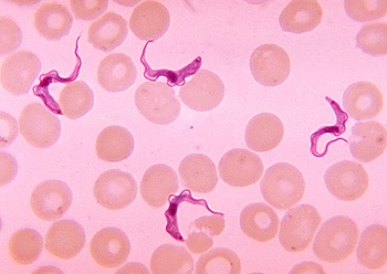 Using Immunologic & Serologic Tests to Identify Parasites | Study.com