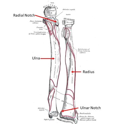 Radial Notch Una