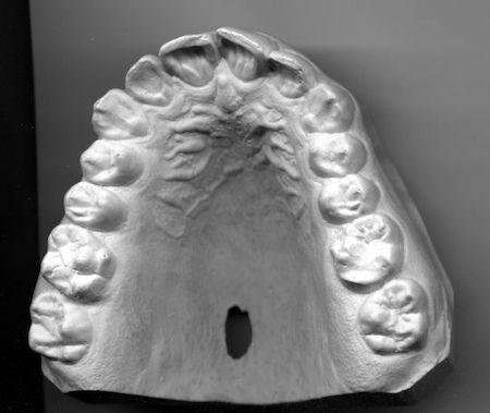 Animal Dental Formula | Types, Functions & Arrangements - Lesson ...