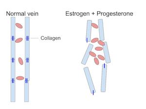 Deep Vein Thrombosis & Pregnancy | Study.com