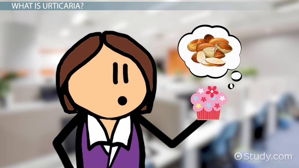 What Is Urticaria? - Definition, Causes, Symptoms & Treatment - Video ...