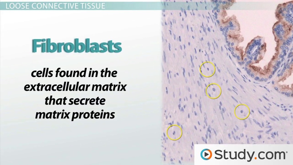 Types Of Connective Tissue Video Lesson Transcript Study Types Of Connective Tissue Video Lesson Transcript Study