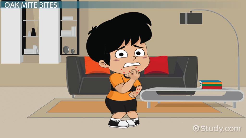 Oak Mites | Overview, Bites & Treatment - Lesson | Study.com