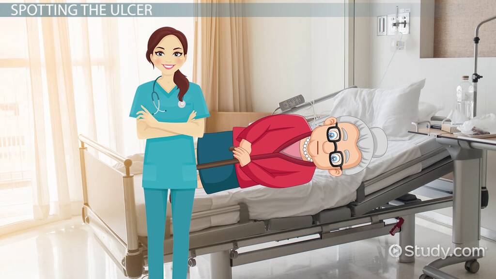 Kennedy Terminal Ulcer | Overview & Treatment - Lesson | Study.com