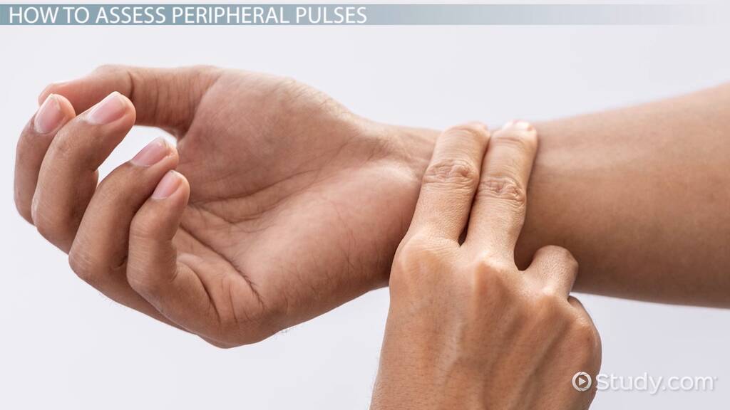 Peripheral Pulses Location Assessment Importance Video Lesson