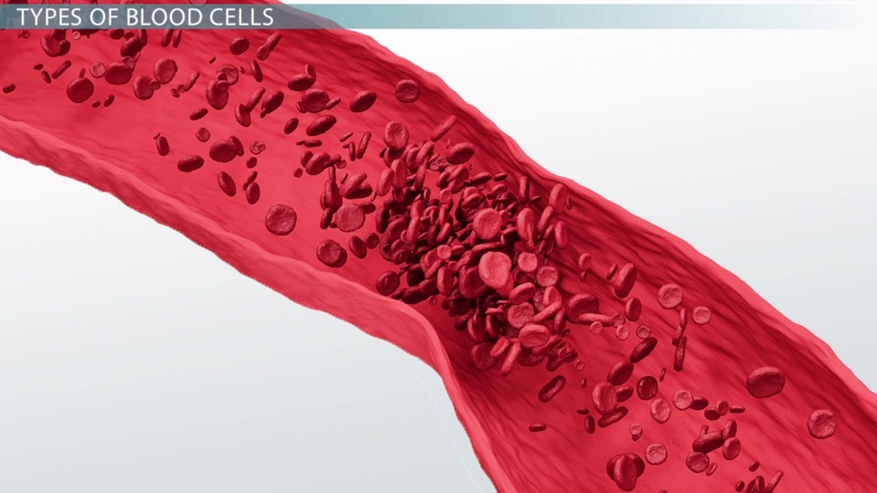 Blood Cell Disorder Vocabulary - Lesson | Study.com