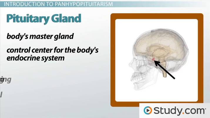Simmonds' Disease and Sheehan's Syndrome - Lesson | Study.com