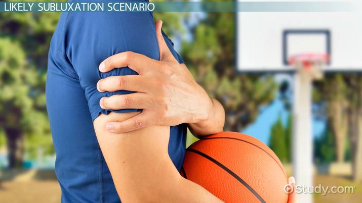 What Is Subluxation? - Definition, Symptoms & Treatment - Lesson ...