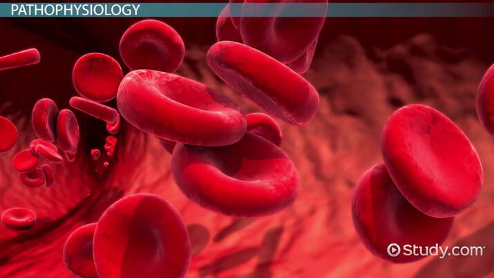 Hyaline Arteriolosclerosis | Mechanisms, Causes & Consequences - Video ...