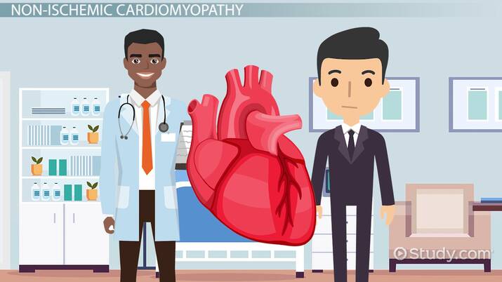 Nonischemic Cardiomyopathy: Definition, Symptoms & Causes - Lesson ...