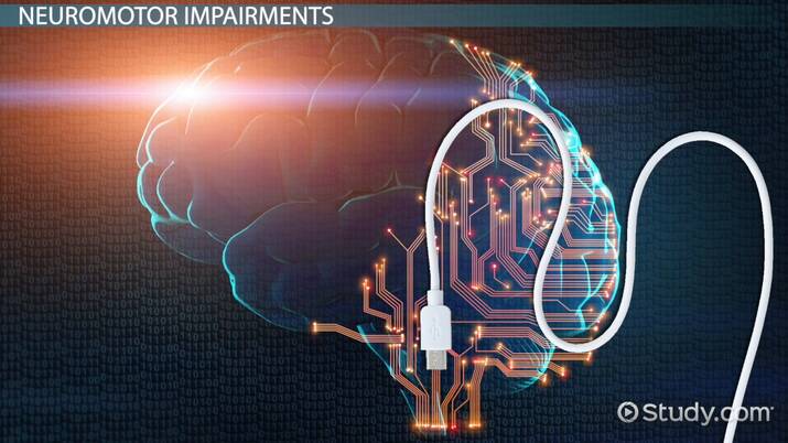 Orthopedic Impairment | Definition, Causes & Characteristics - Lesson ...