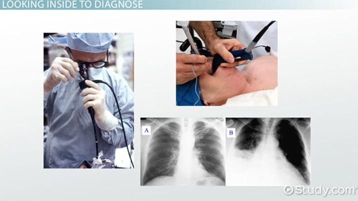 Diagnostic Imaging for Respiratory Diseases: Terminology - Lesson ...