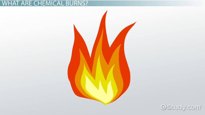Alkali Burns vs. Acid Burns - Lesson | Study.com