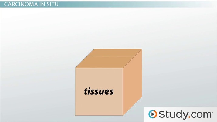 Neoplasm | Definition, Types, Causes & Treatment - Lesson | Study.com