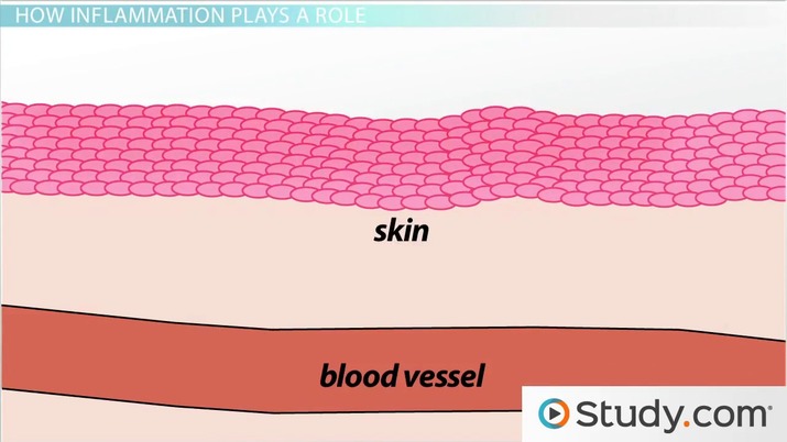 Causes and Consequences of Damage to the Skin - Video | Study.com