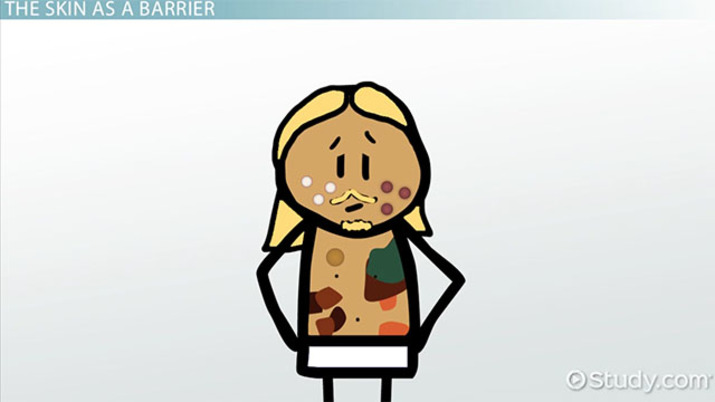 Infectious Skin Conditions & Treatments: Medical Terms - Lesson | Study.com