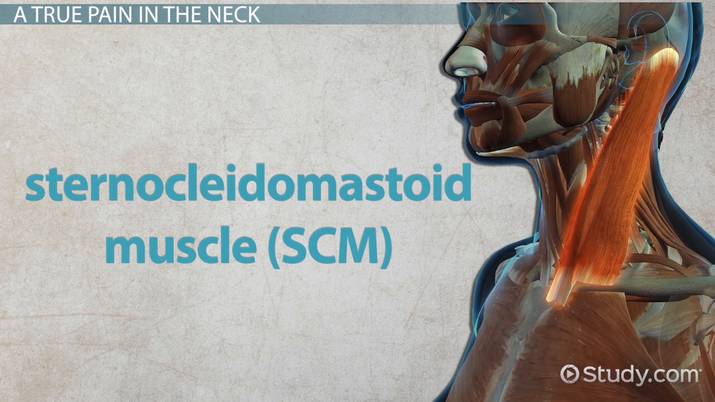 What Causes Swollen Sternocleidomastoid Muscle