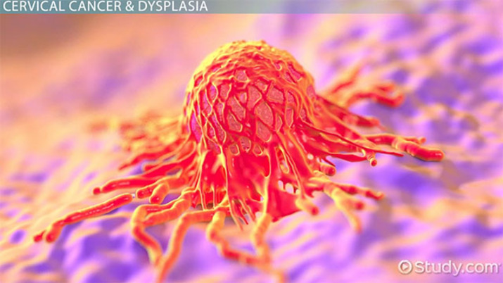 Pathologies of the Cervix: Terminology - Video | Study.com
