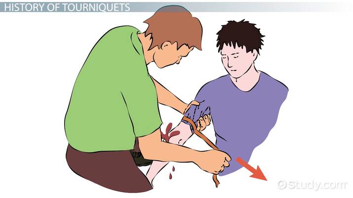 Tourniquet Definition, Types & Uses - Lesson | Study.com