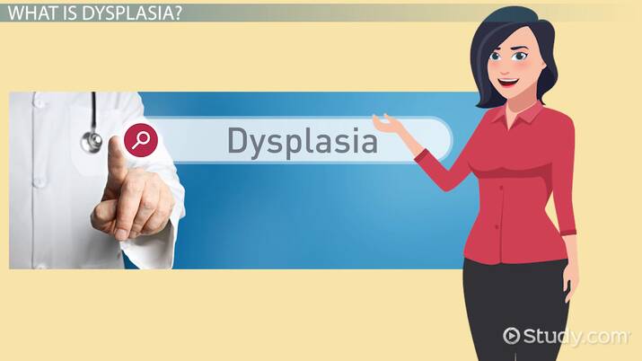 What Is Dysplasia? - Definition, Symptoms & Treatment - Lesson | Study.com