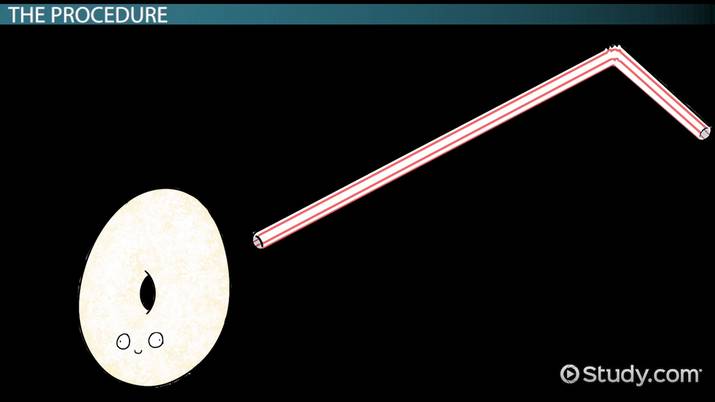 What Is TURP Surgery? - Definition, Complications & Recovery - Video ...