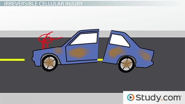 Irreversible Cellular Injury and Death: Types and Causes - Lesson ...