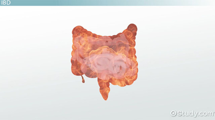 Vocabulary of Inflammatory & Autoimmune Disorders of the Intestinal ...