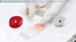 Quiz & Worksheet - What is the Absorption Elution Technique? | Study.com